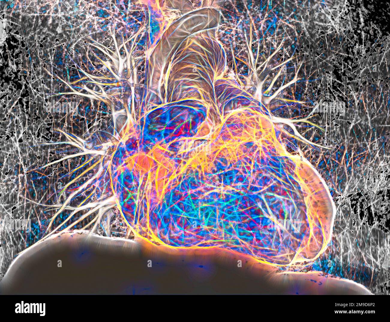 Healthy heart, CT scan Stock Photo - Alamy