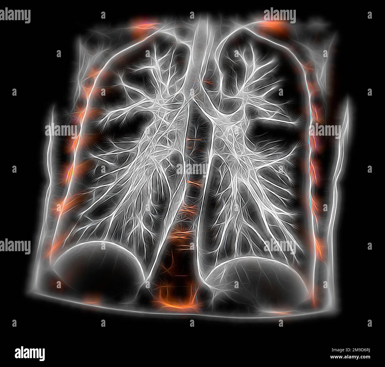 Healthy lungs, CT scan Stock Photo - Alamy
