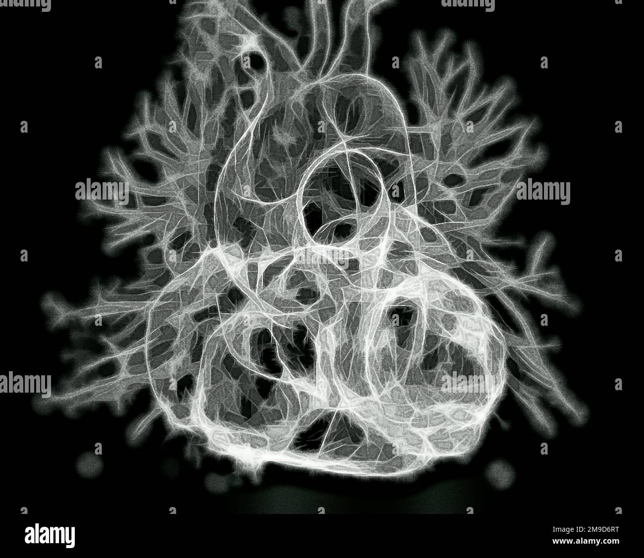 Healthy heart, CT scan Stock Photo - Alamy