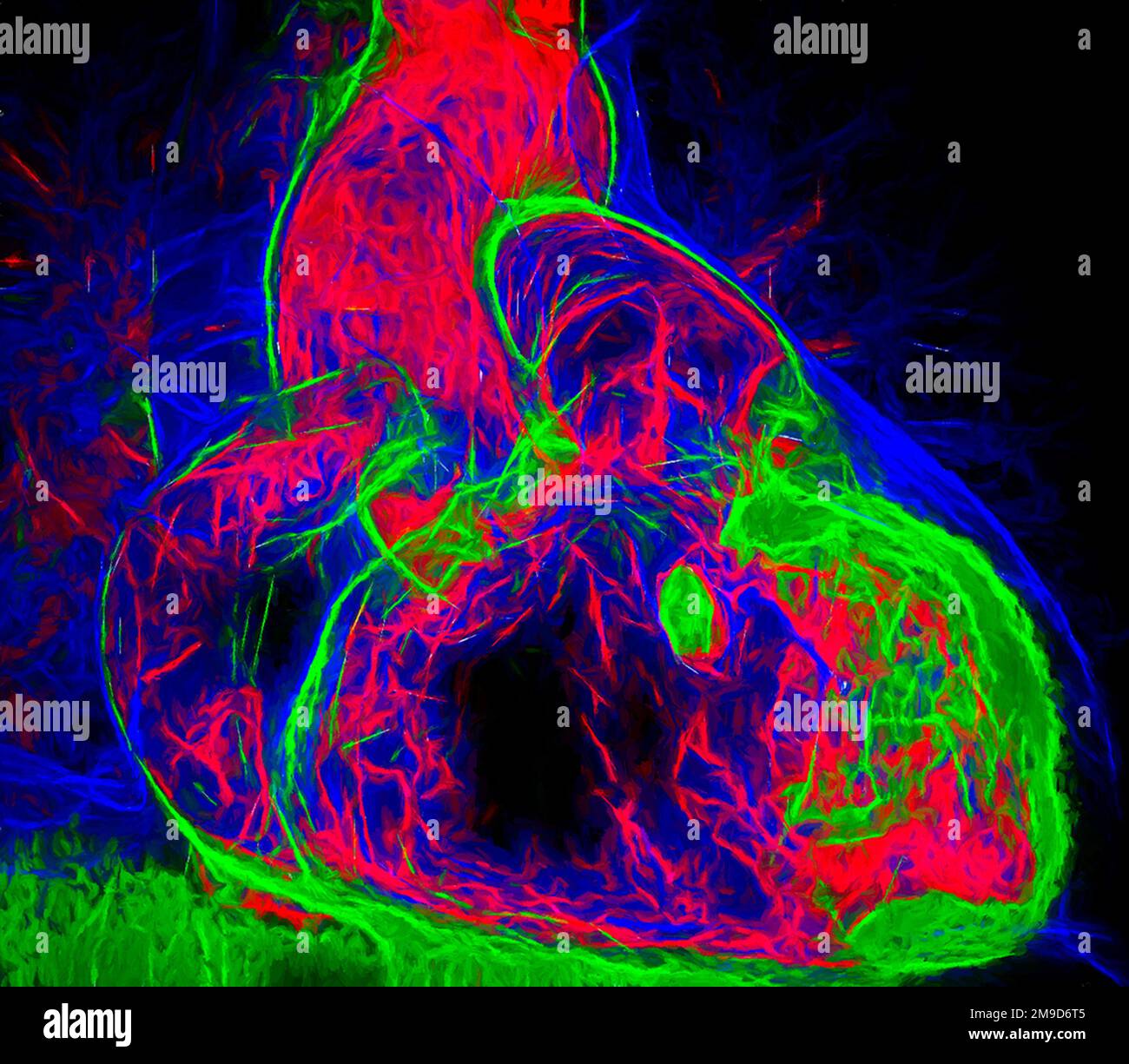 Healthy heart, CT scan Stock Photo - Alamy