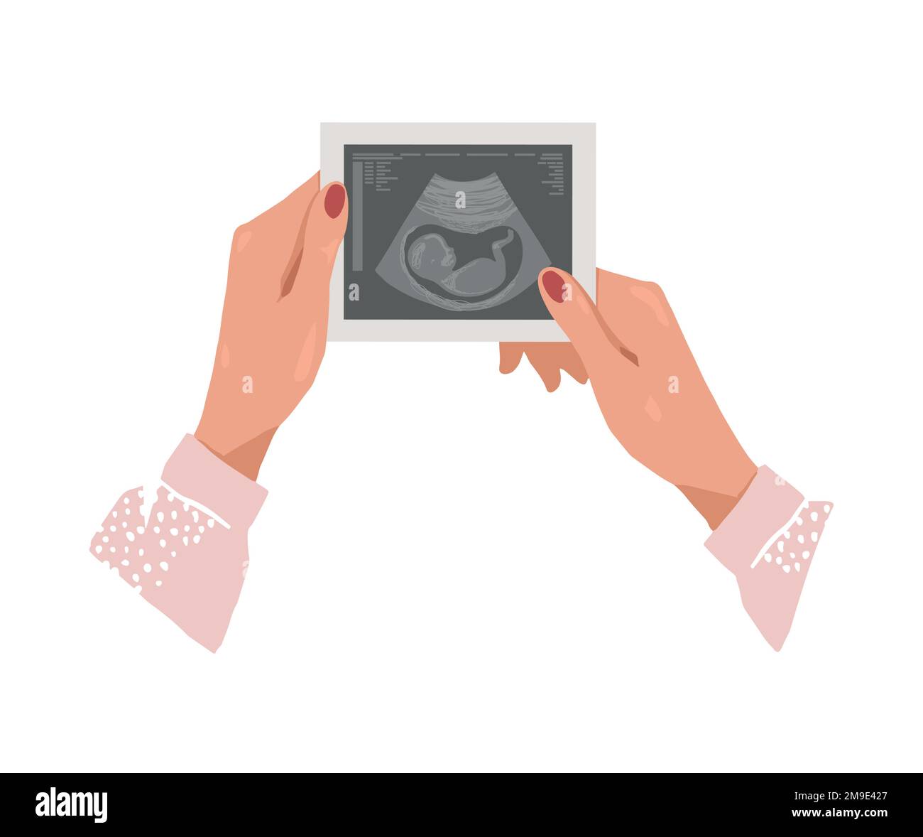 Woman holding baby ultrasound scan in her hands, pregnancy vector ...
