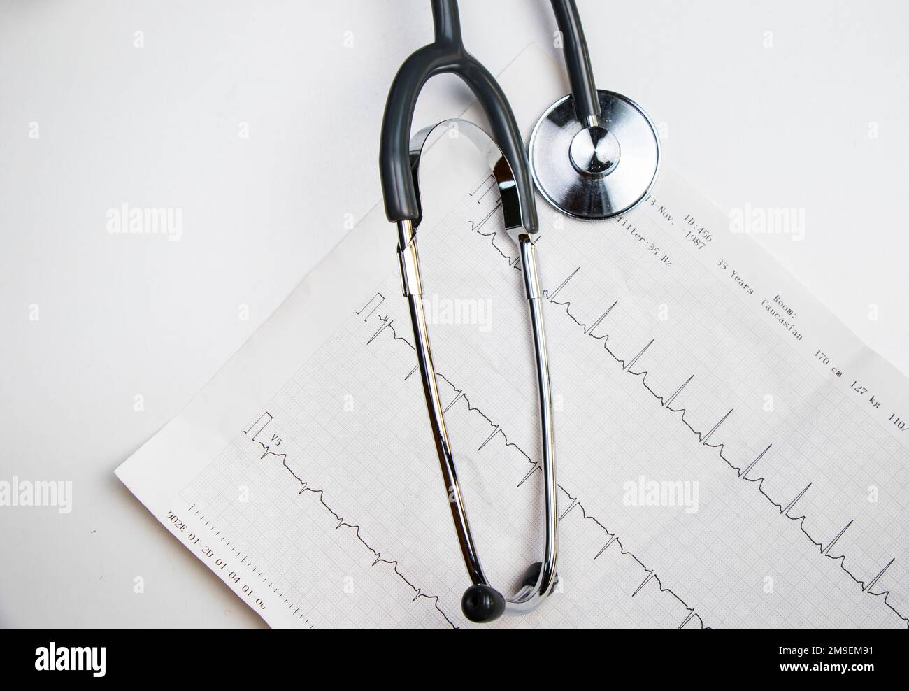 Cardiogram, waves of heart beat, EKG on the paper, arrhythmia Stock ...