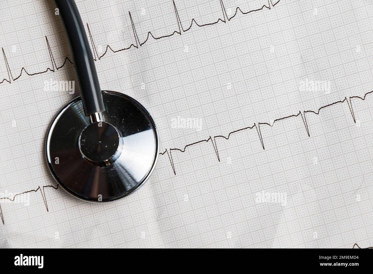 Cardiogram, waves of heart beat, EKG on the paper, arrhythmia Stock ...
