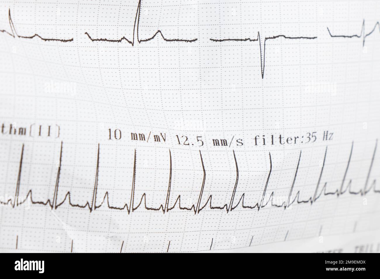 Cardiogram, waves of heart beat, EKG on the paper, arrhythmia Stock ...