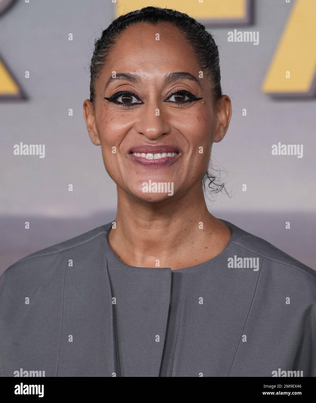 What Happened To Tracee Ellis Ross Eye