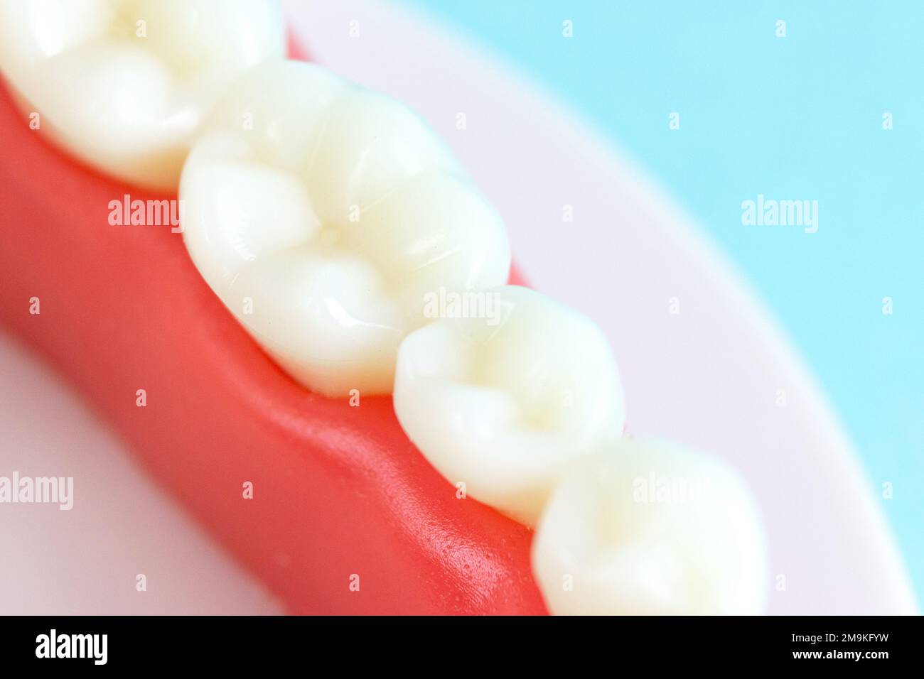 Dental Teeth Model dentures on blue background, close-up.Regular ...