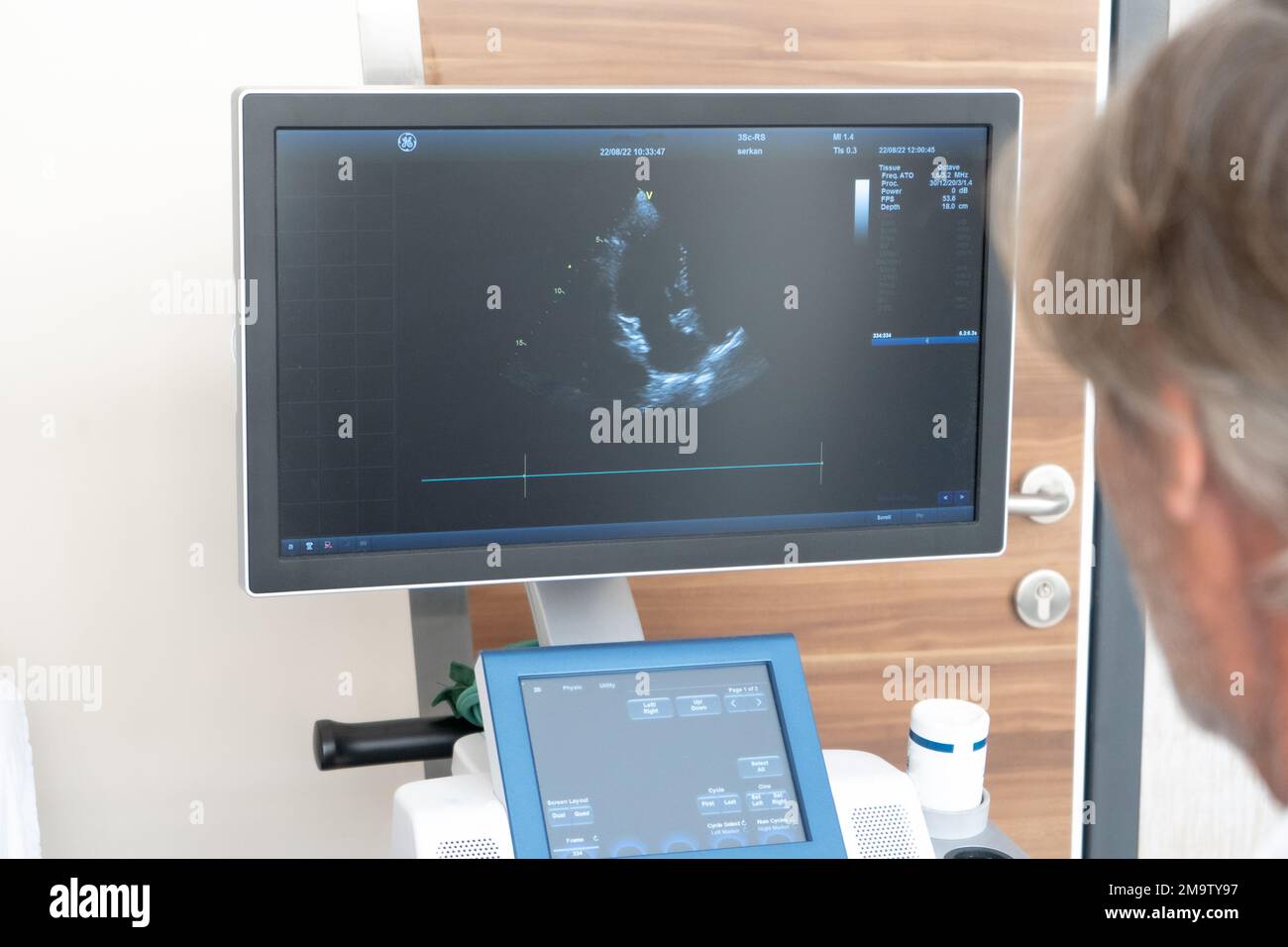 Doctor Looking At Ultrasound Images Doctor Examining Ultrasound Of