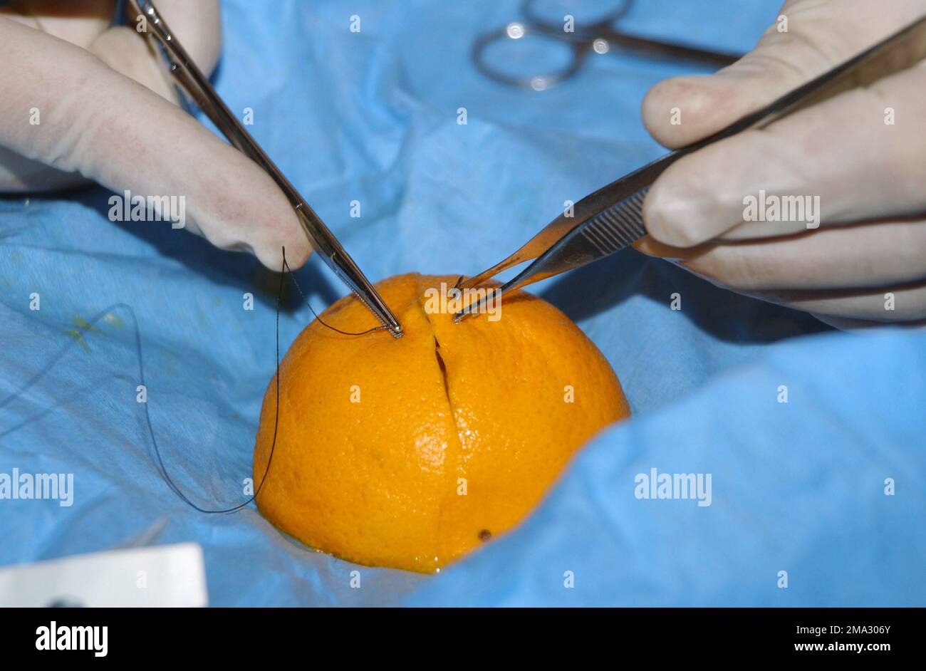 Pulling the suture through the orange skin hi-res stock photography and ...