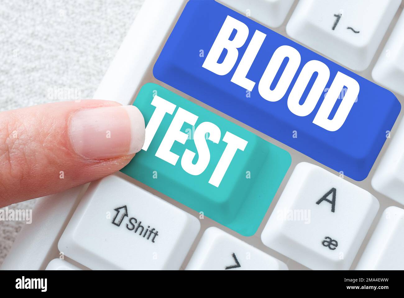Sign displaying Blood Test. Business approach Extracted blood sample ...