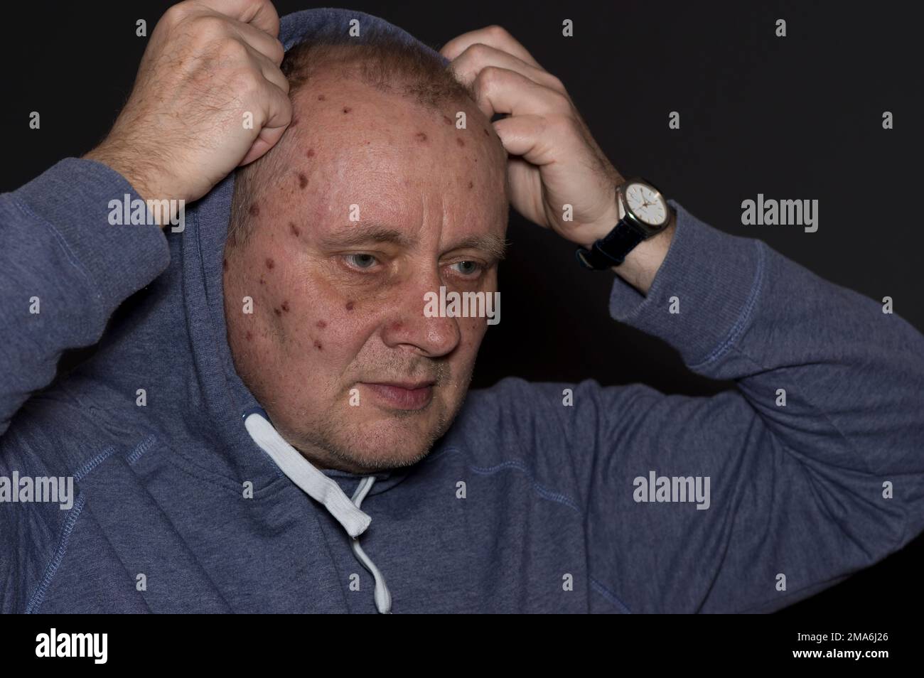 Low key Portait of Caucasian mature in man hoodie after face skin ...