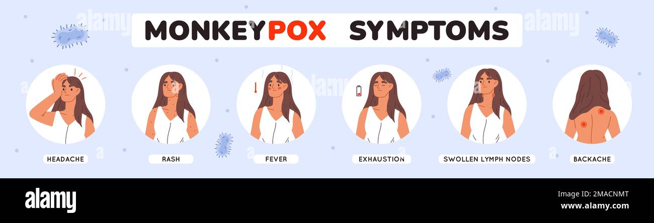Ad banner design Monkeypox virus symptoms. Background template with ...