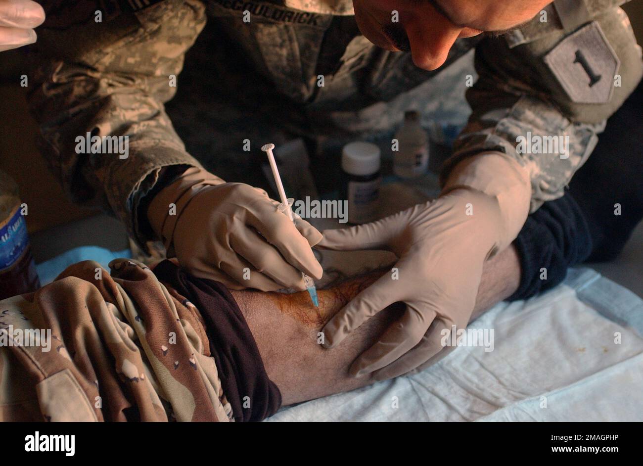 Cyst removal hi-res stock photography and images - Alamy