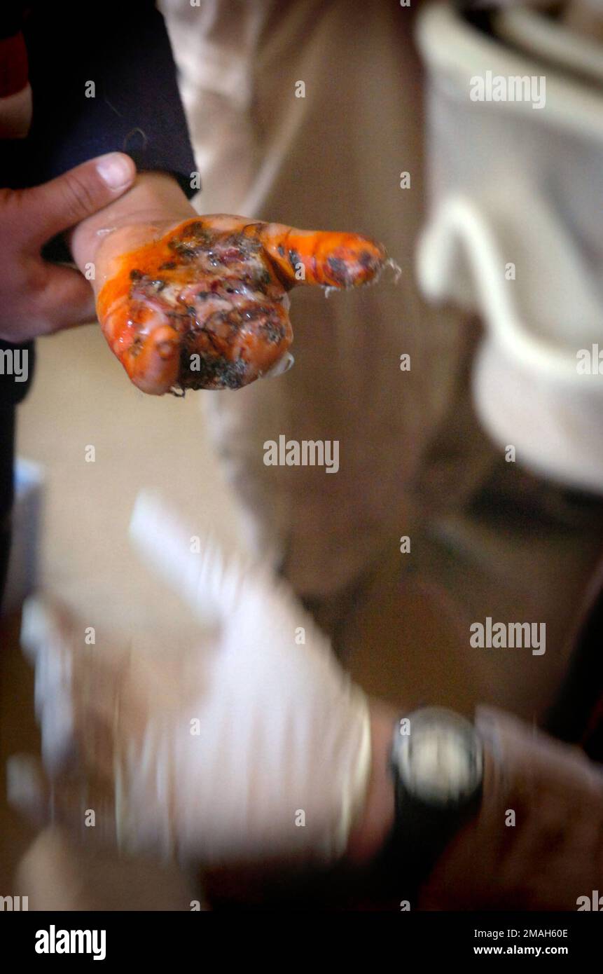 Care leaver hi-res stock photography and images - Alamy