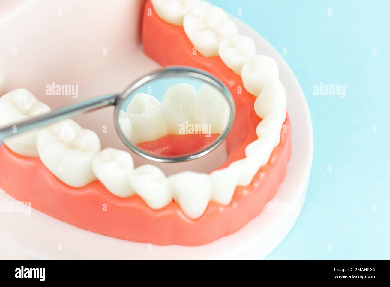 Dentistry conceptual photo. Close-up individual tooth tray Orthodontic ...