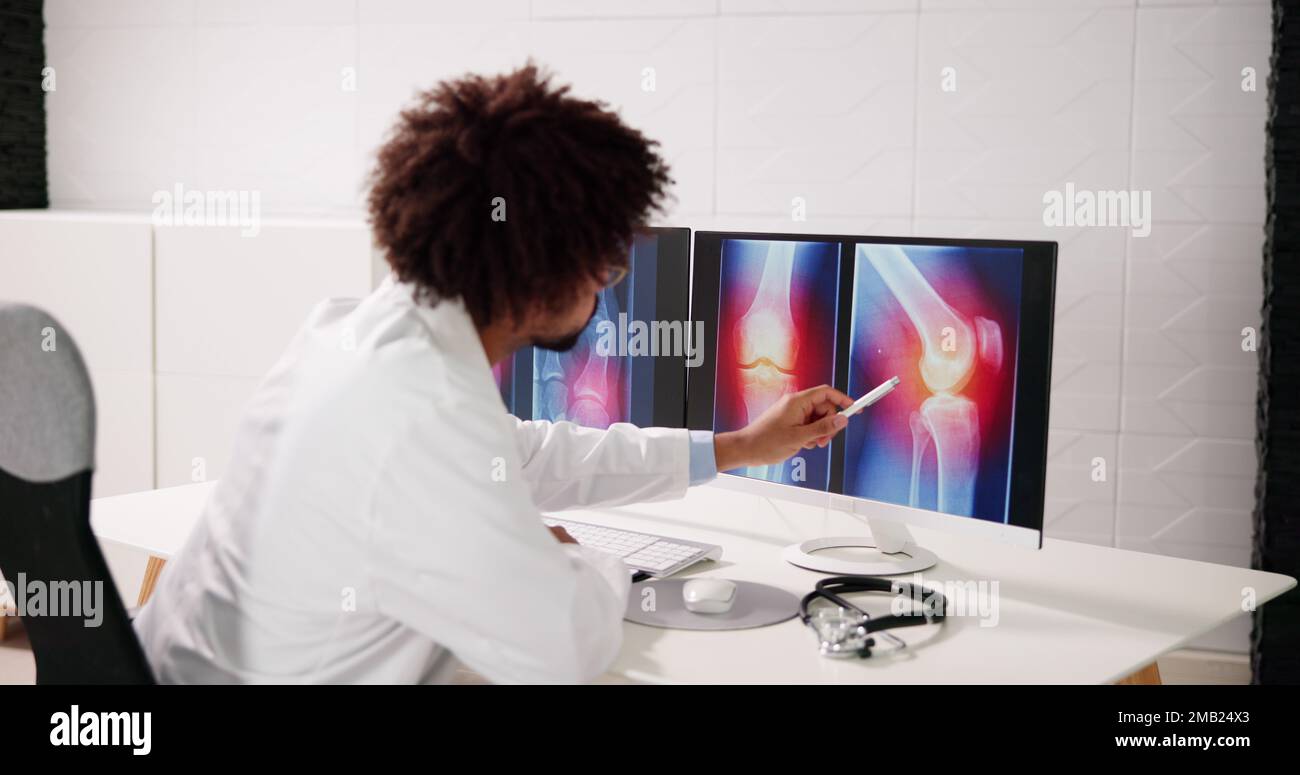 Doctor Screening Knee Bone X Ray On Computer Stock Photo - Alamy