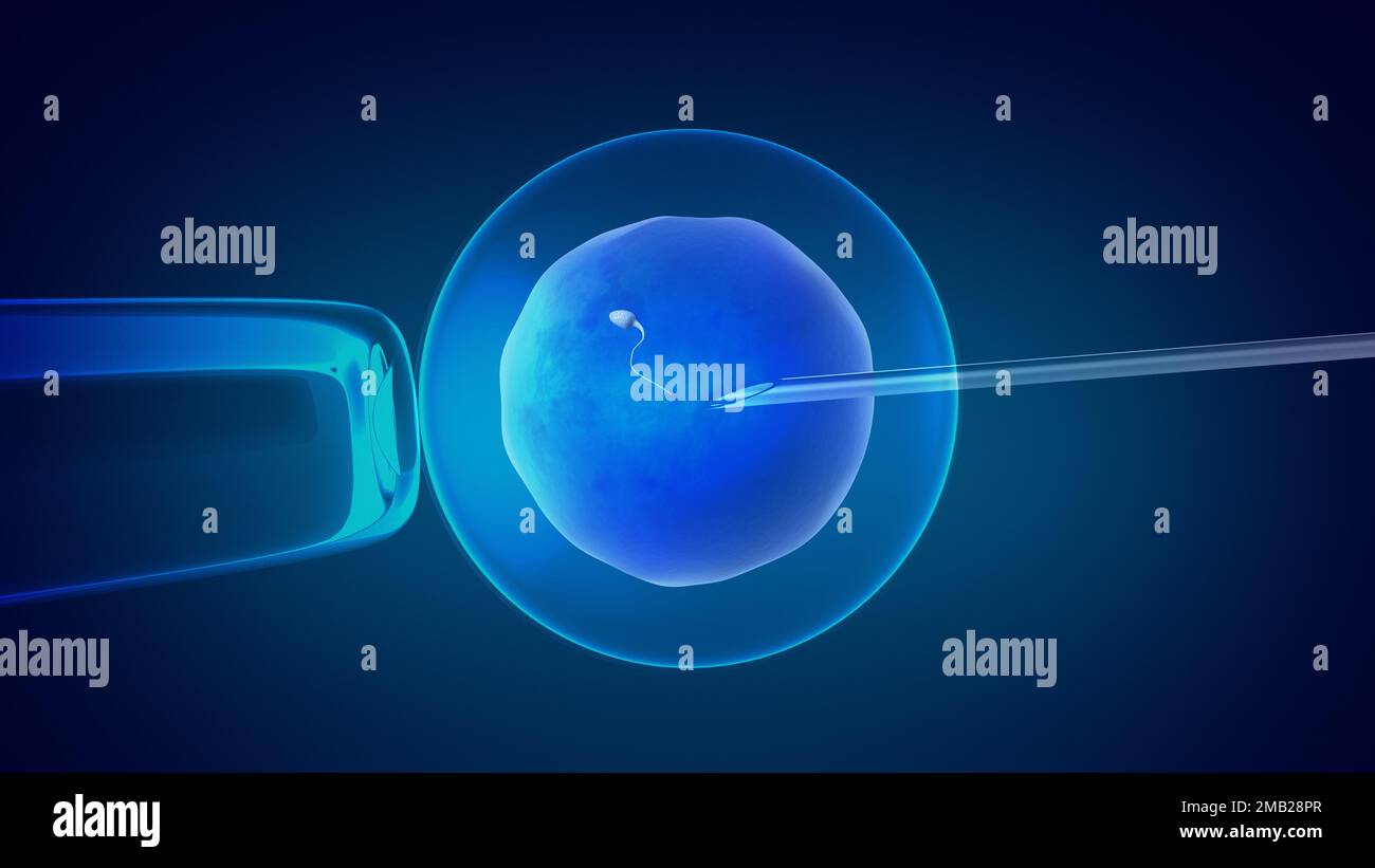 In vitro fertilization concept artificial insemination. 3d illustration ...