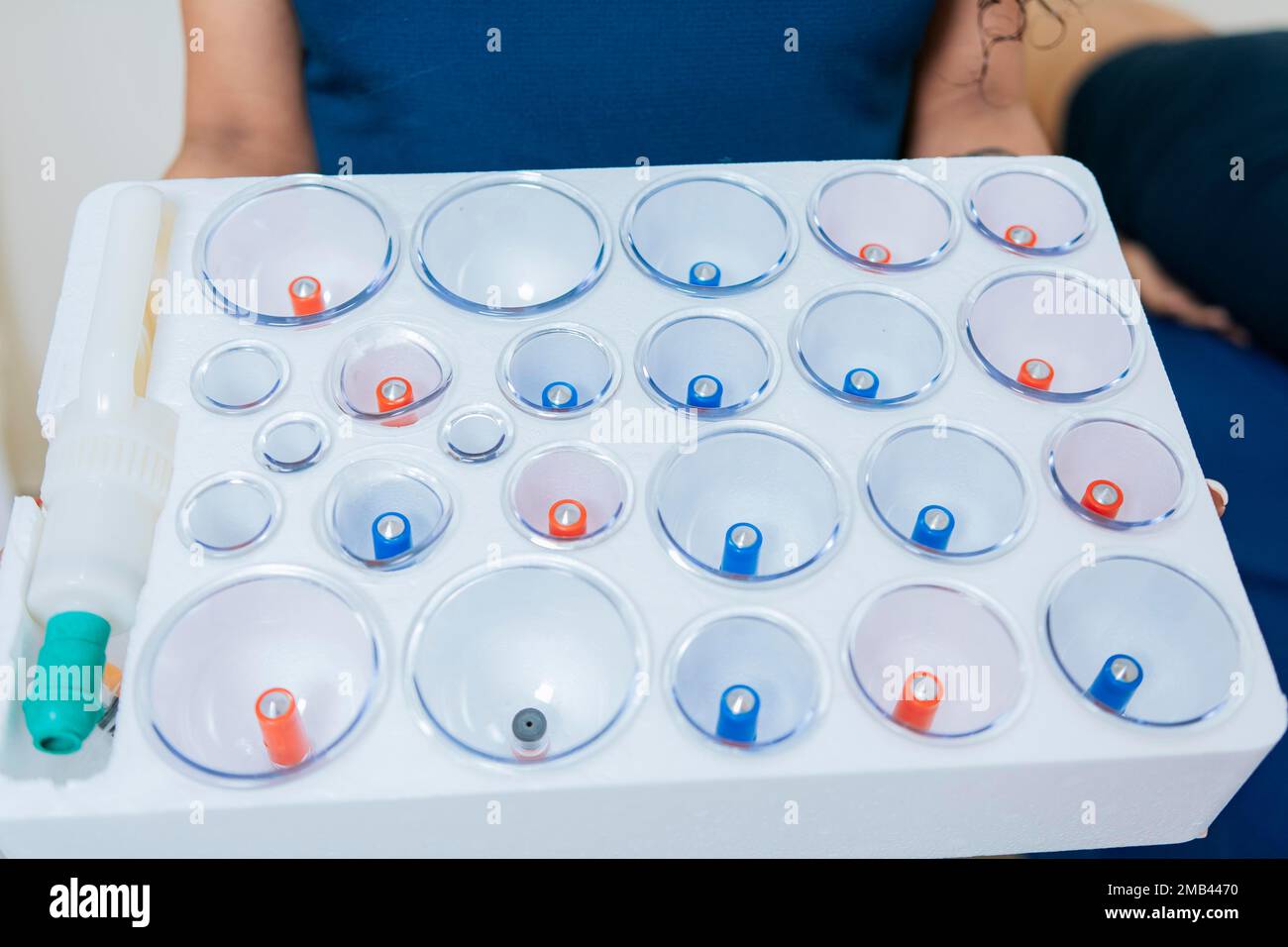 Cupping kit for physiotherapy. Physiotherapist hands holding cupping ...