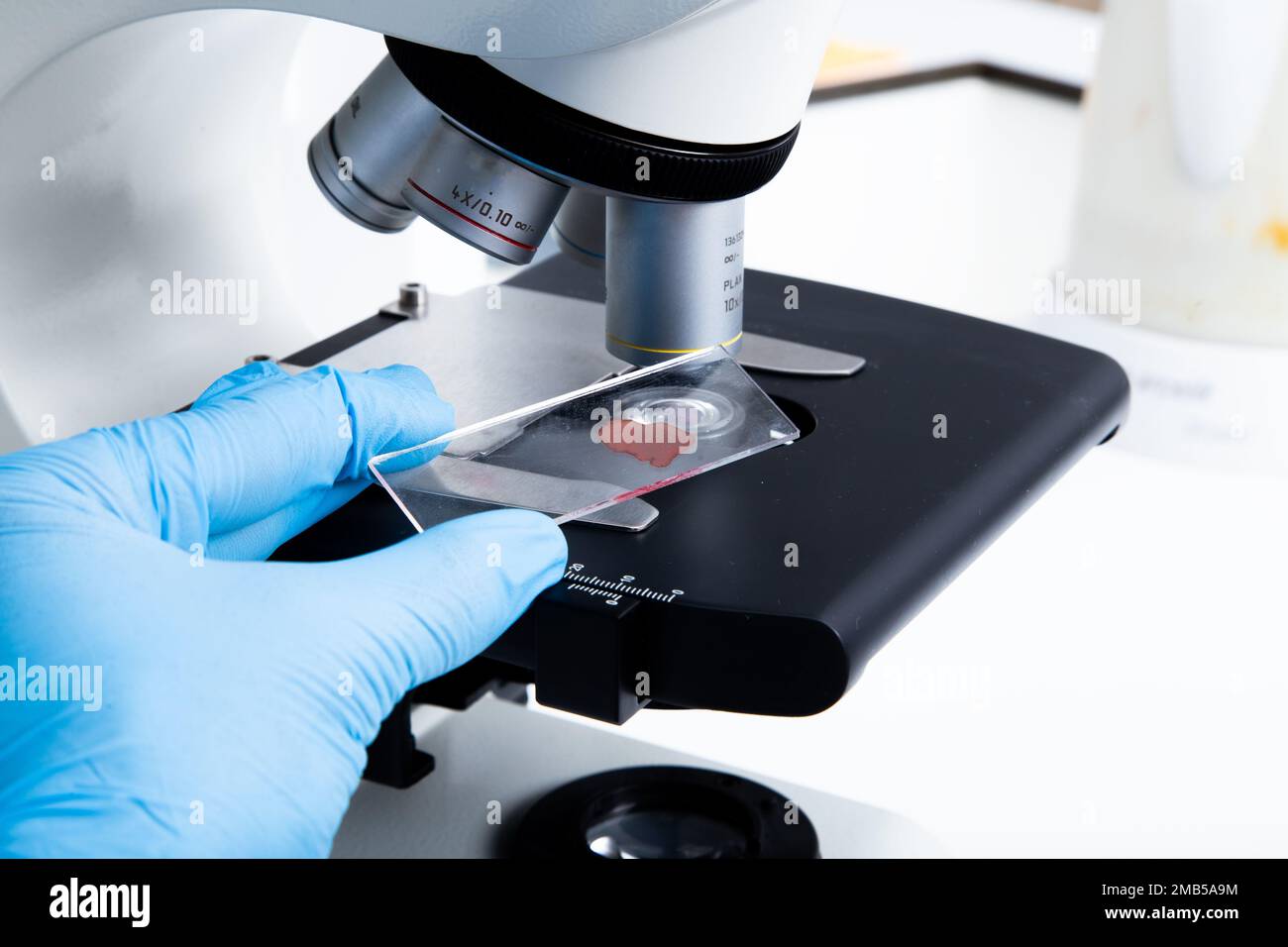 Blood laboratory microscope hi-res stock photography and images - Alamy