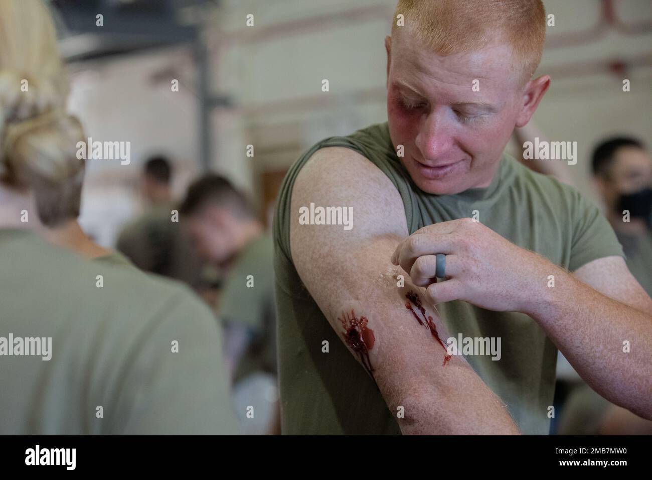 Bullet Wound Treatment