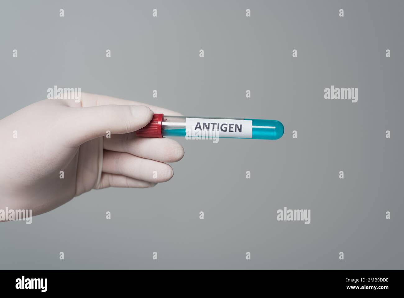 Cropped view of doctor in latex glove holding test tube with antigen ...