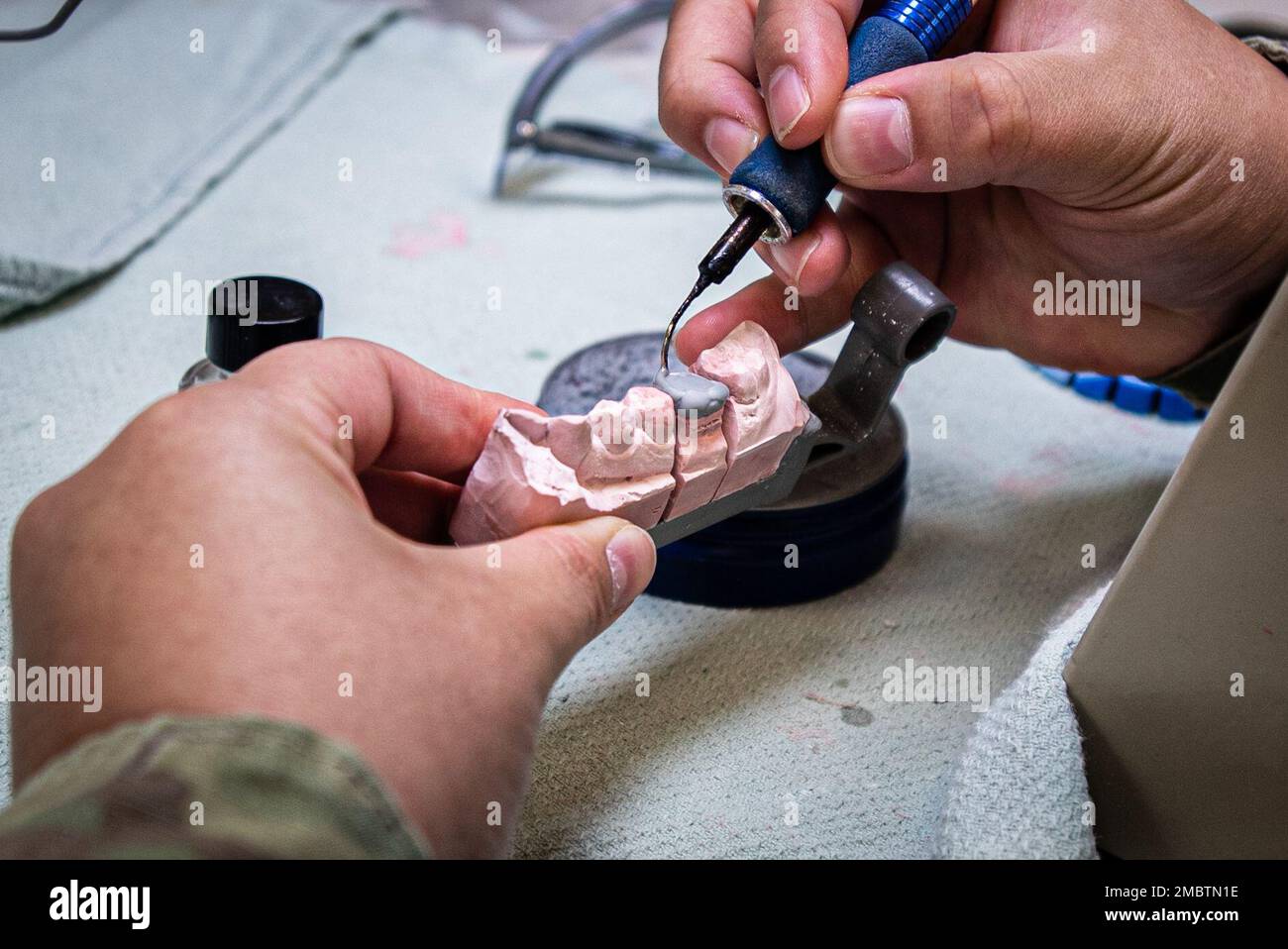 Diagnostic wax up hi-res stock photography and images - Alamy