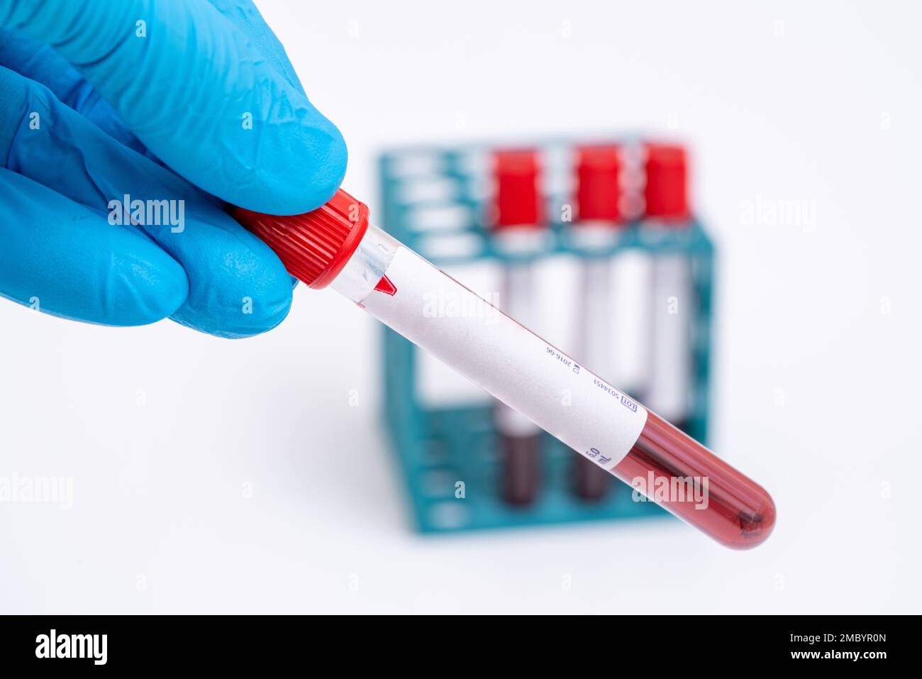 test tubes with blood samples for biochemical analysis in a medical ...