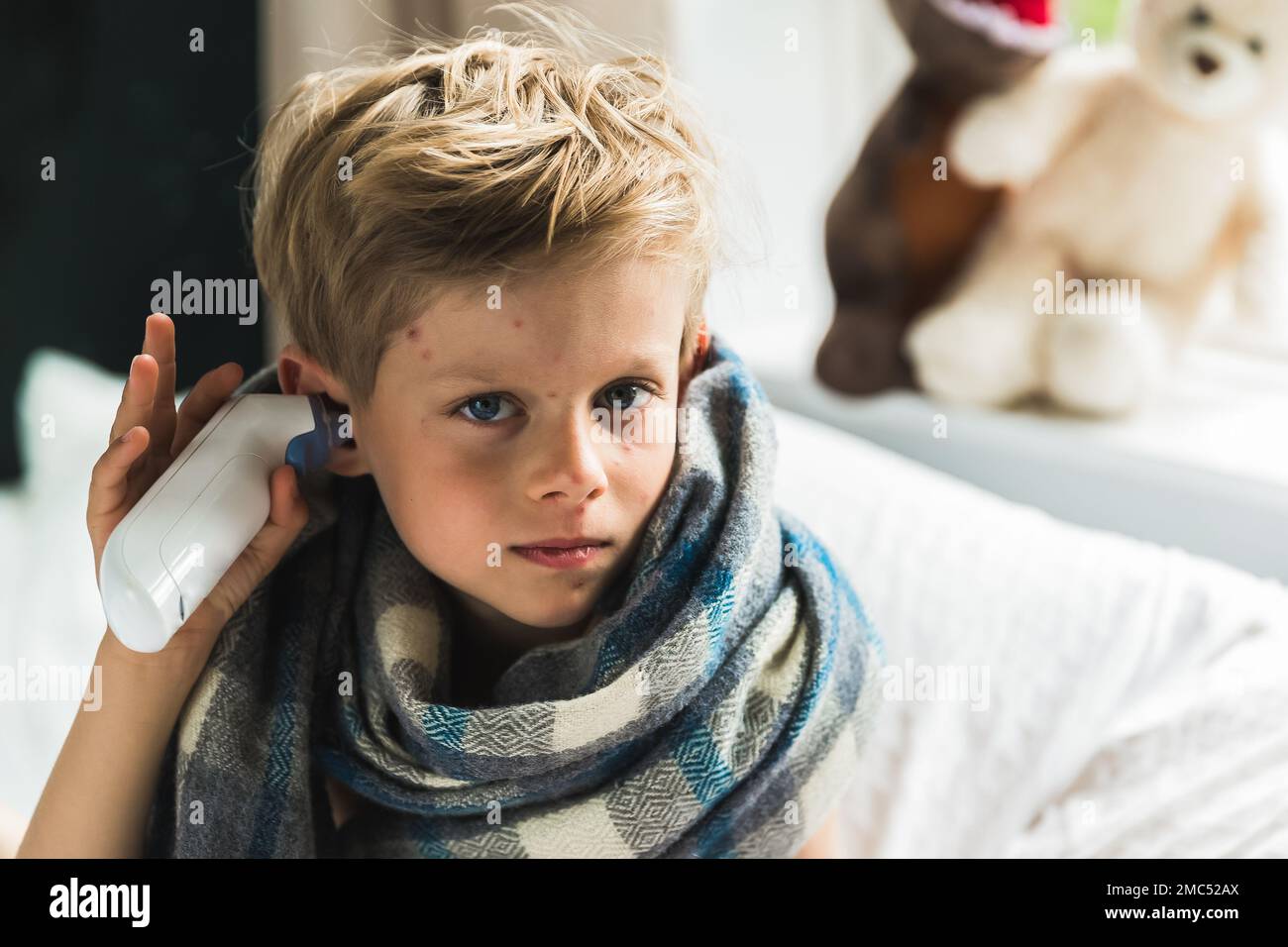 Young toddler with chickenpox. Sick child with chickenpox. Varicella ...