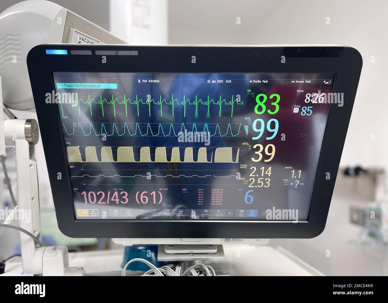 Hospital Monitors electrocardiogram pulse blood pressure anesthesia ...