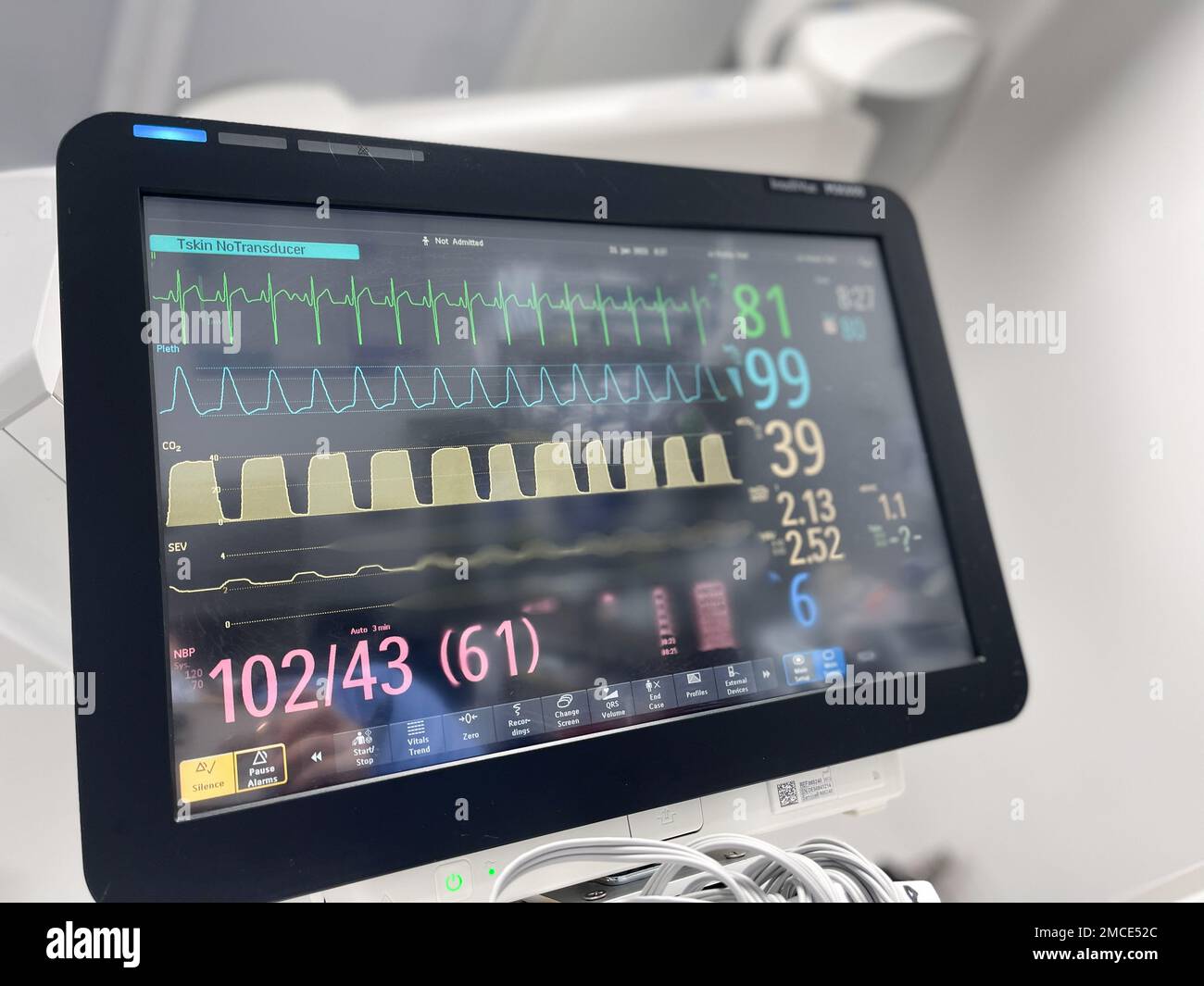 Hospital Monitors electrocardiogram pulse blood pressure anesthesia ...
