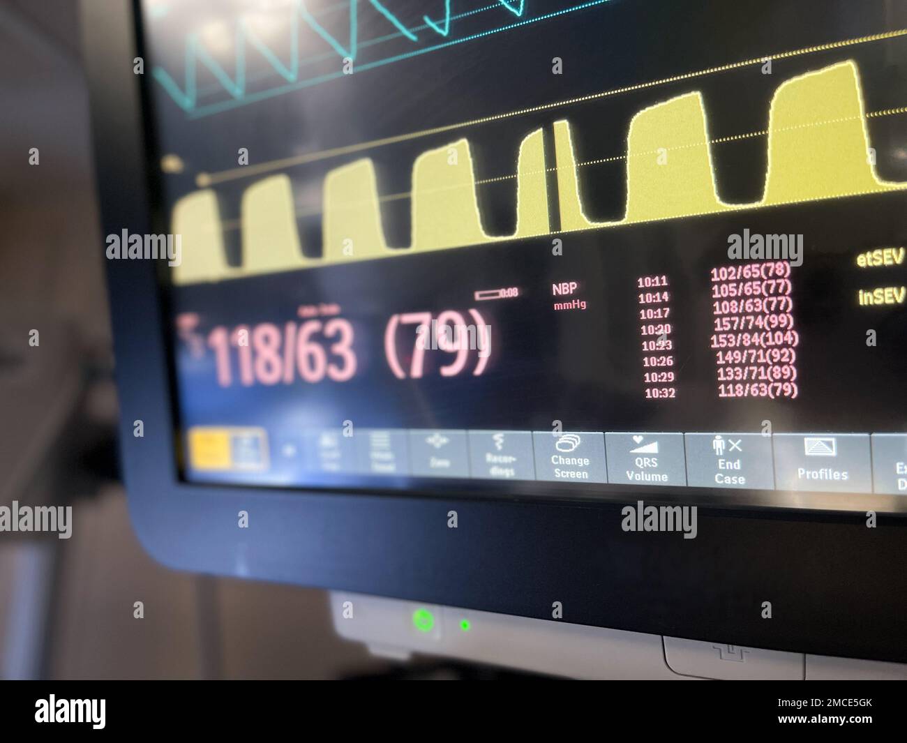 Hospital Monitors electrocardiogram pulse blood pressure anesthesia ...
