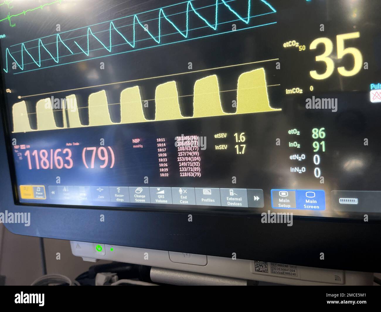 Hospital Monitors electrocardiogram pulse blood pressure anesthesia ...