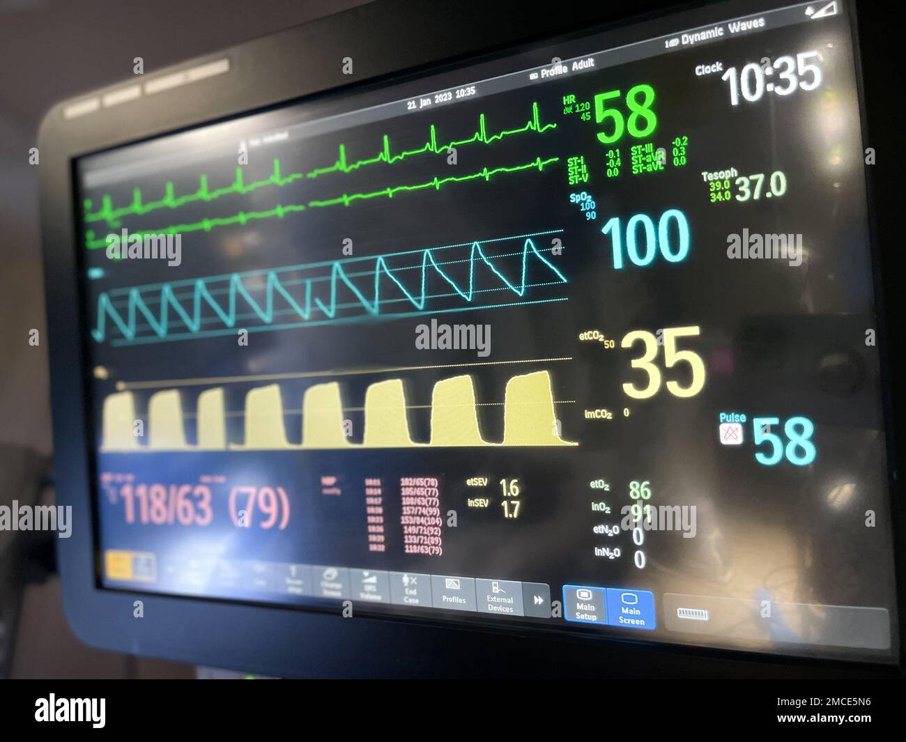 Hospital Monitors electrocardiogram pulse blood pressure anesthesia ...