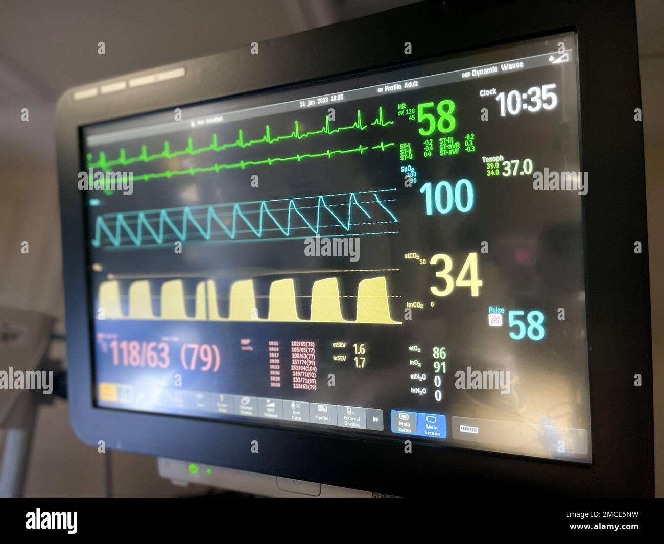 Hospital Monitors electrocardiogram pulse blood pressure anesthesia ...