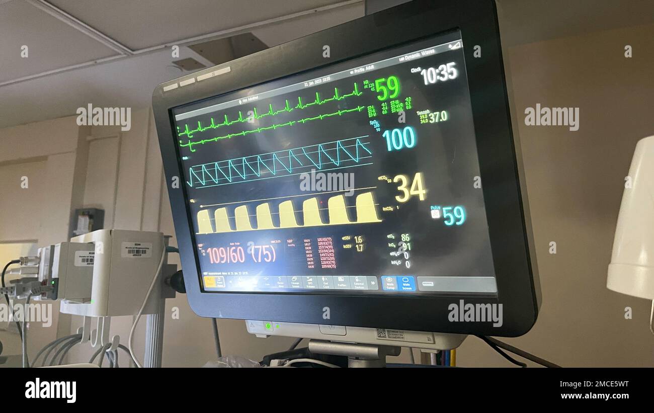 Hospital Monitors electrocardiogram pulse blood pressure anesthesia ...