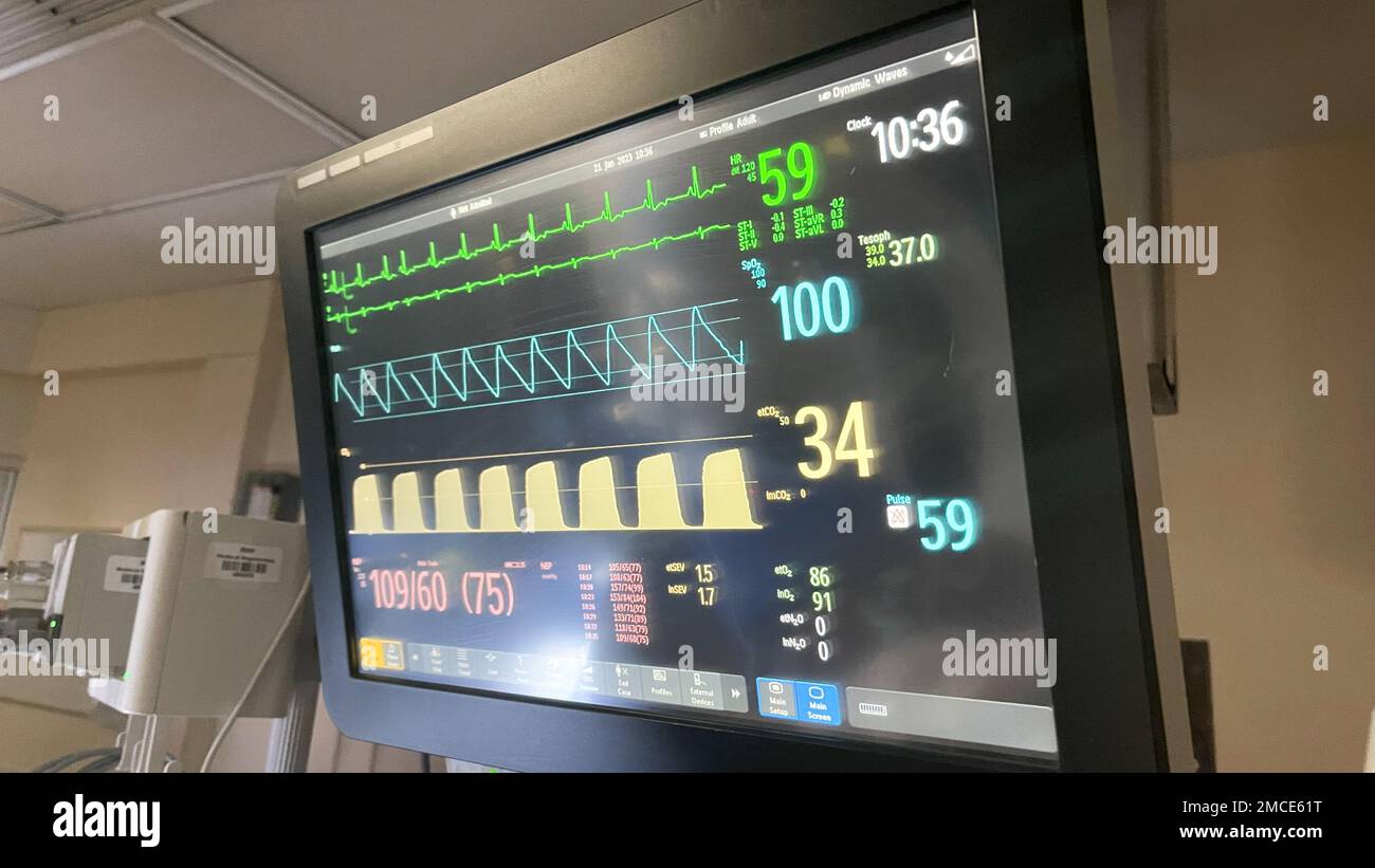 Hospital Monitors electrocardiogram pulse blood pressure anesthesia ...