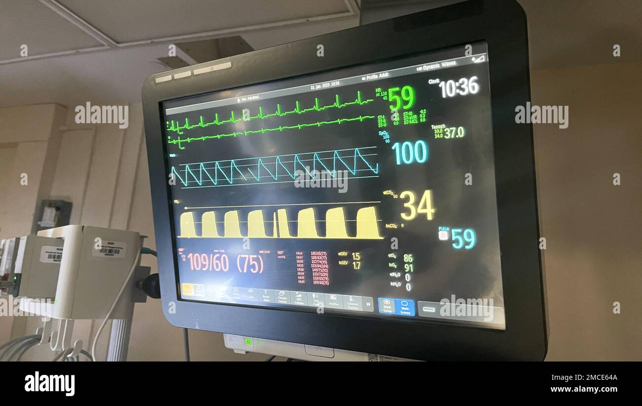Hospital Monitors electrocardiogram pulse blood pressure anesthesia ...
