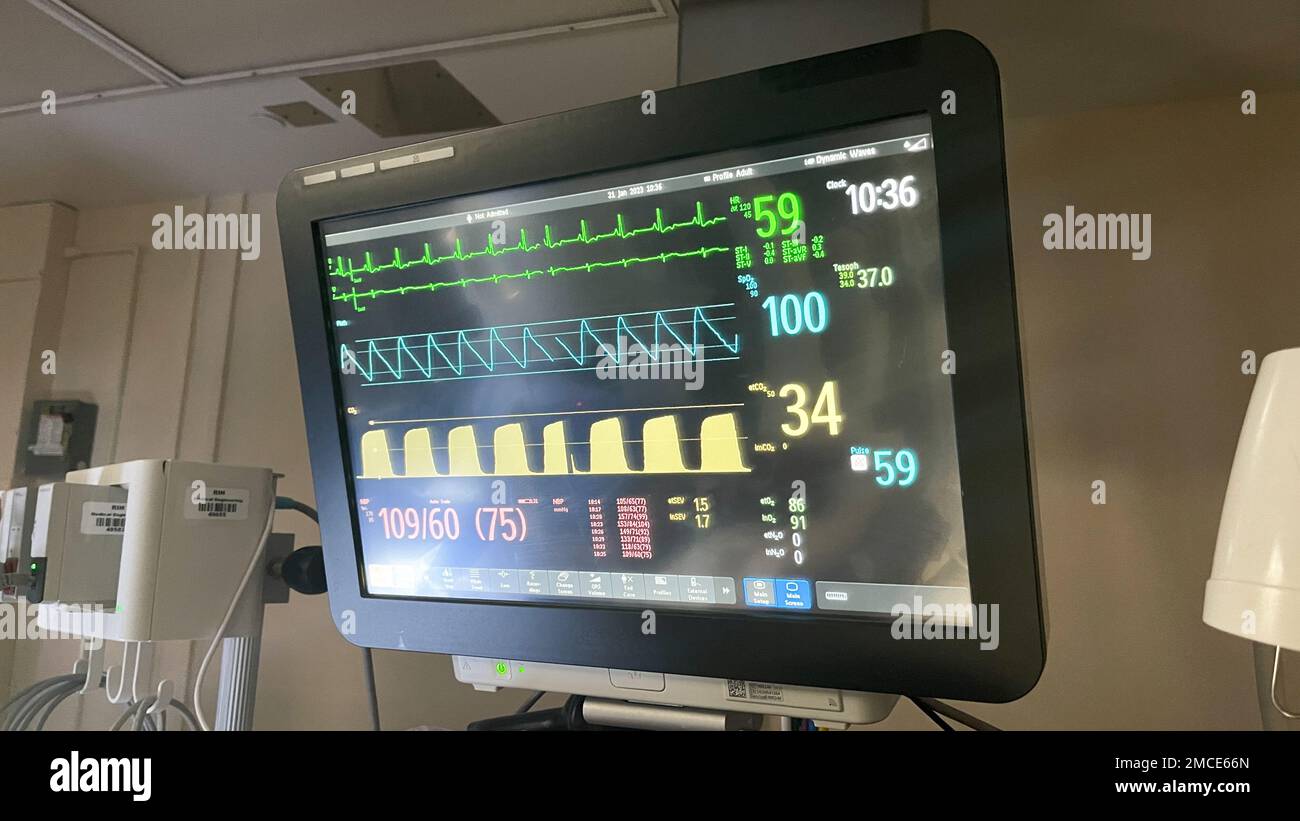 Hospital Monitors electrocardiogram pulse blood pressure anesthesia ...