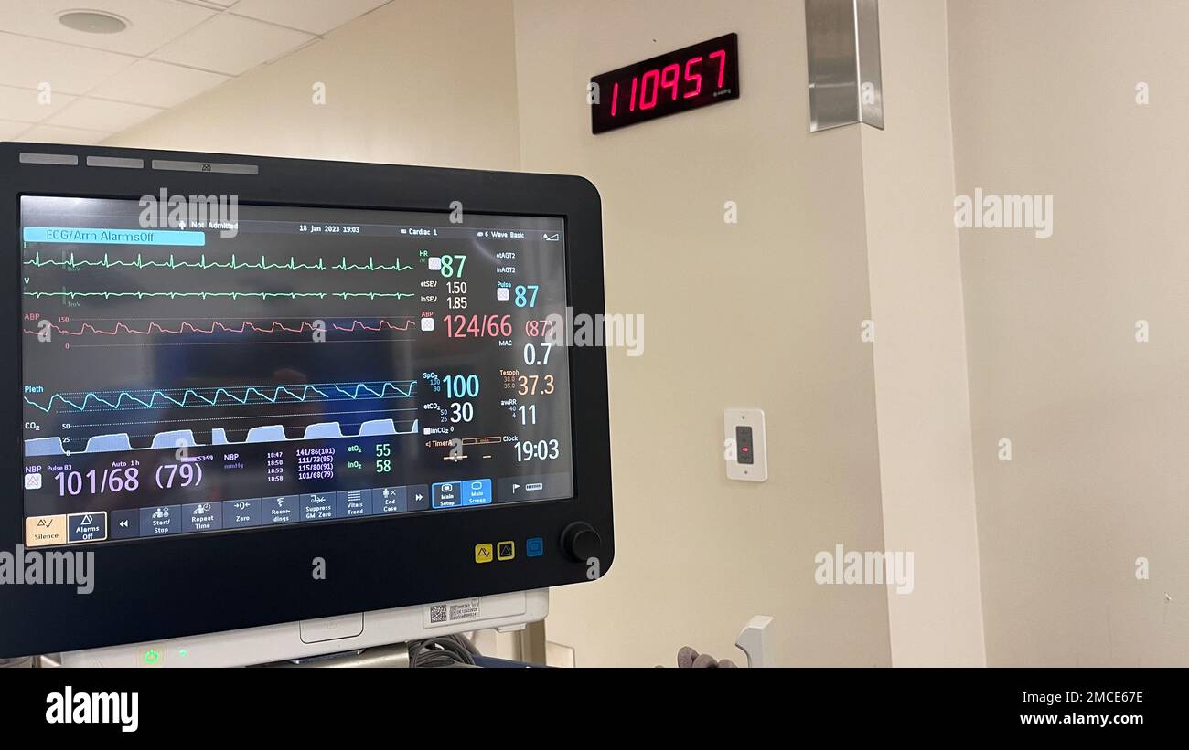 Hospital Monitors electrocardiogram pulse blood pressure anesthesia ...