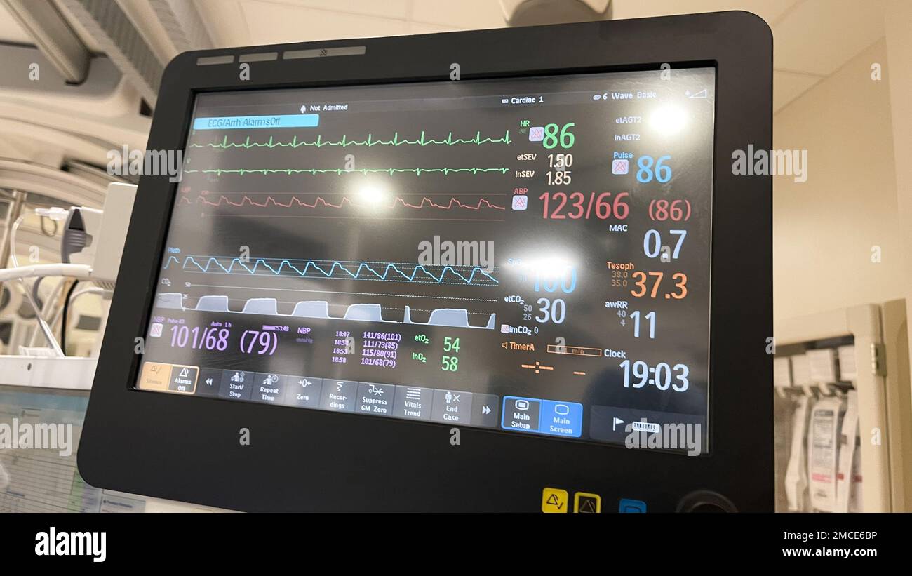 Hospital Monitors electrocardiogram pulse blood pressure anesthesia ...
