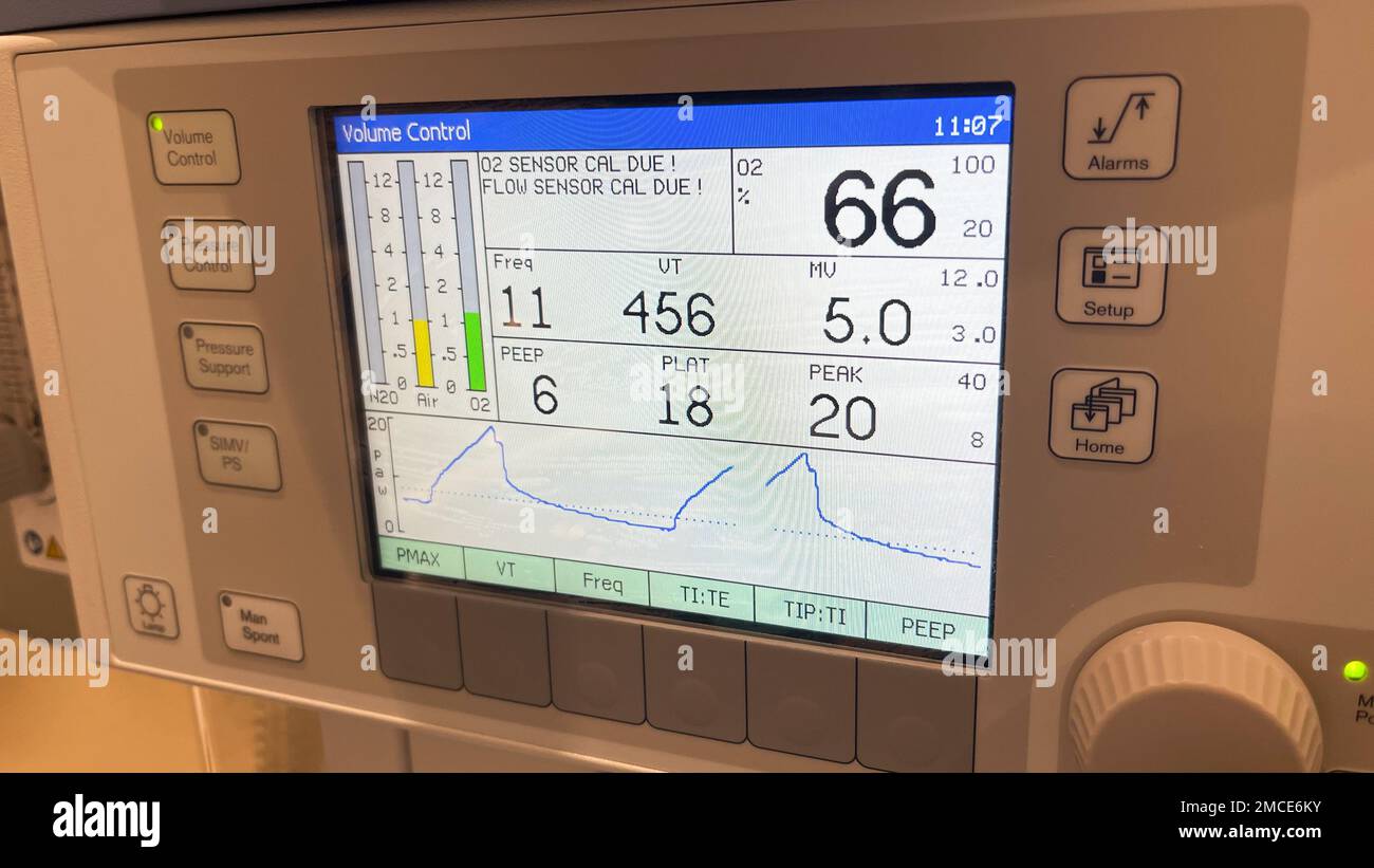 Hospital Monitors electrocardiogram pulse blood pressure anesthesia ...