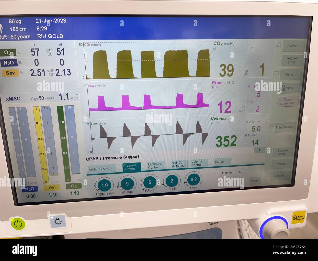 Hospital Monitors electrocardiogram pulse blood pressure anesthesia ...