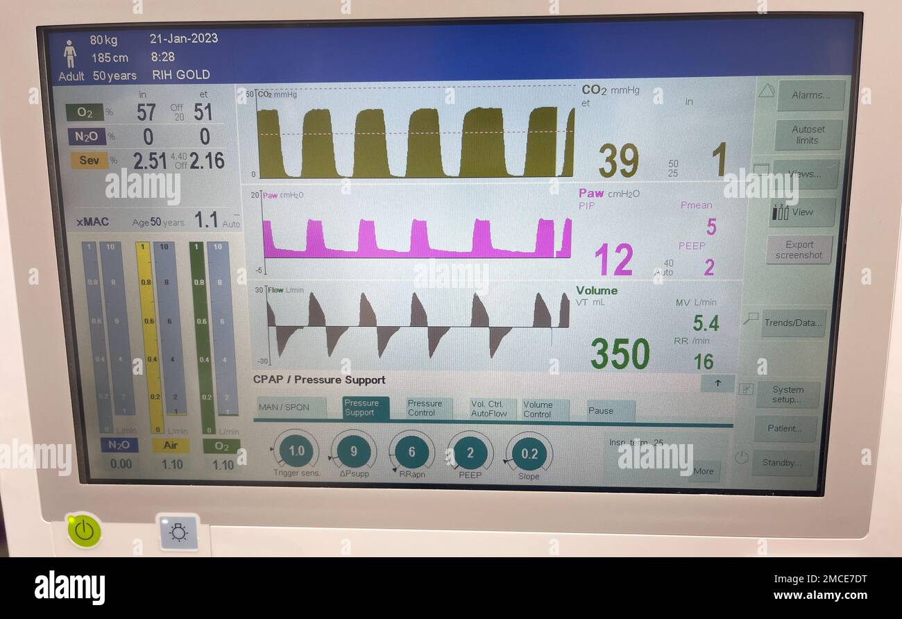 Hospital Monitors electrocardiogram pulse blood pressure anesthesia ...