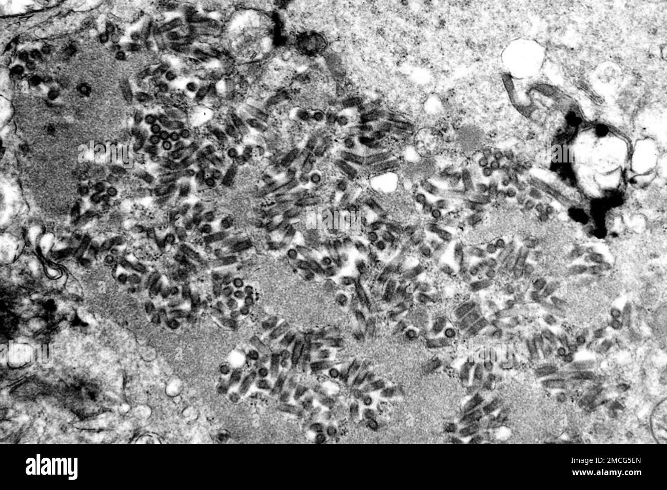 This undated electron microscope image made available by the Centers ...