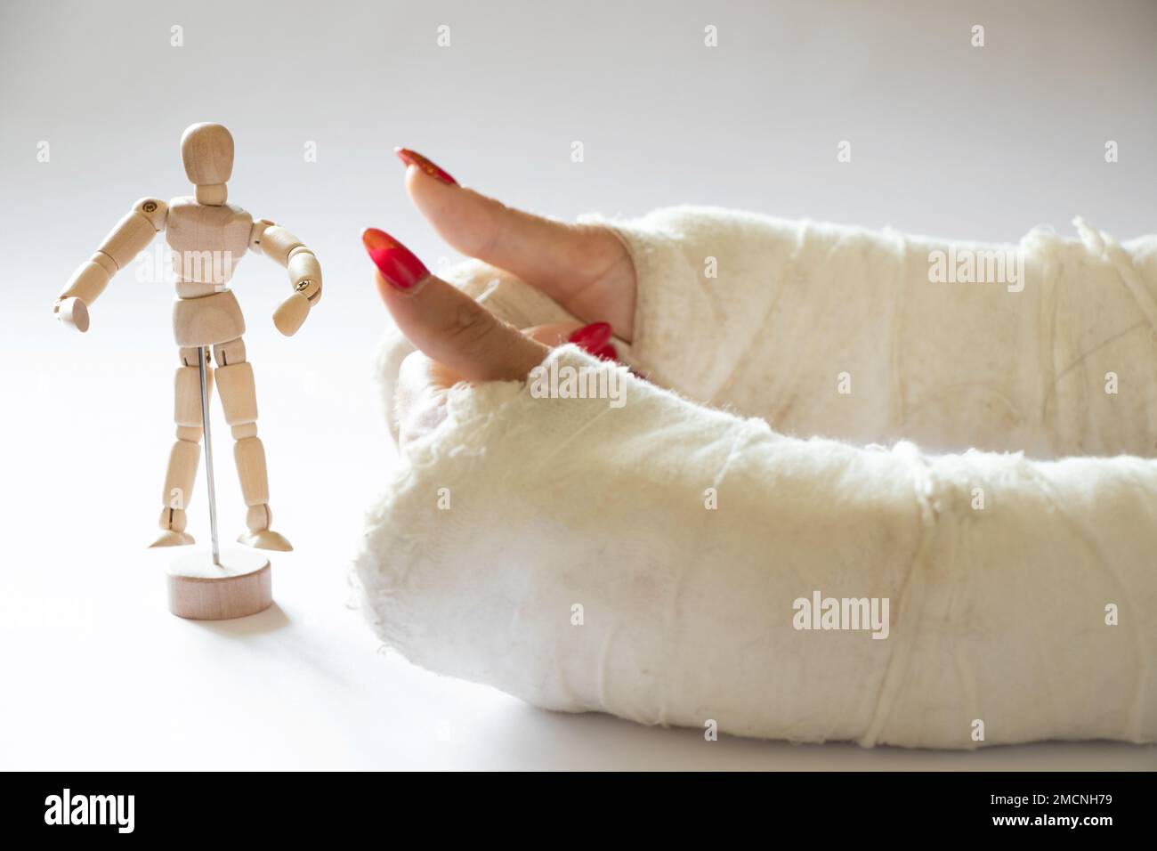 two female hands with broken wrists after falling from a bicycle in a ...