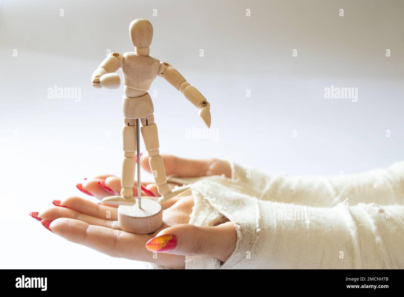 two female hands with broken wrists after falling from a bicycle in a ...