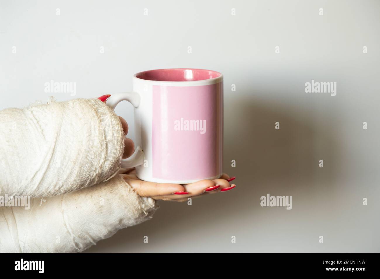 Girl patient arm plaster hi-res stock photography and images - Alamy