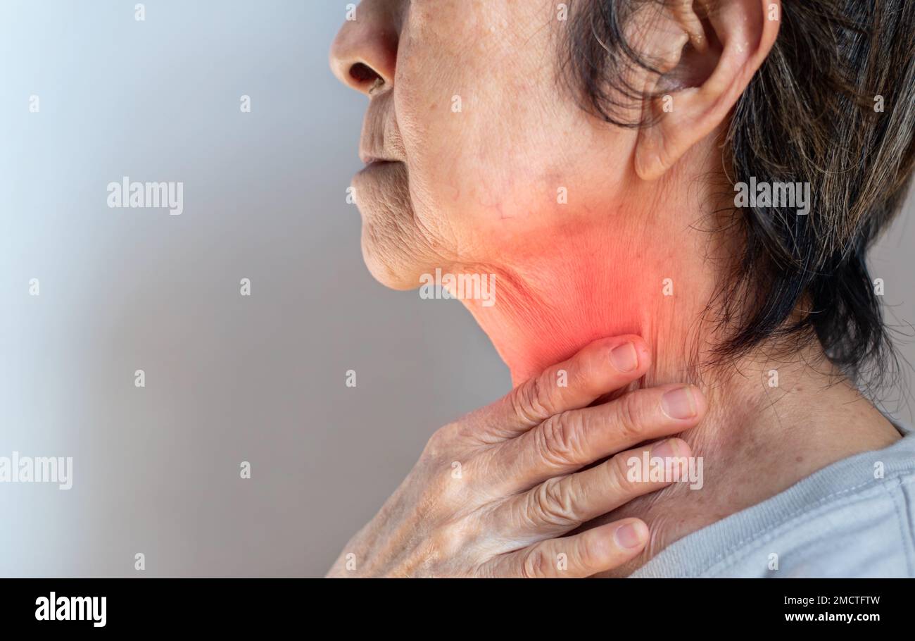 Redness at the neck of Asian, Myanmar woman. Concept of sore throat ...