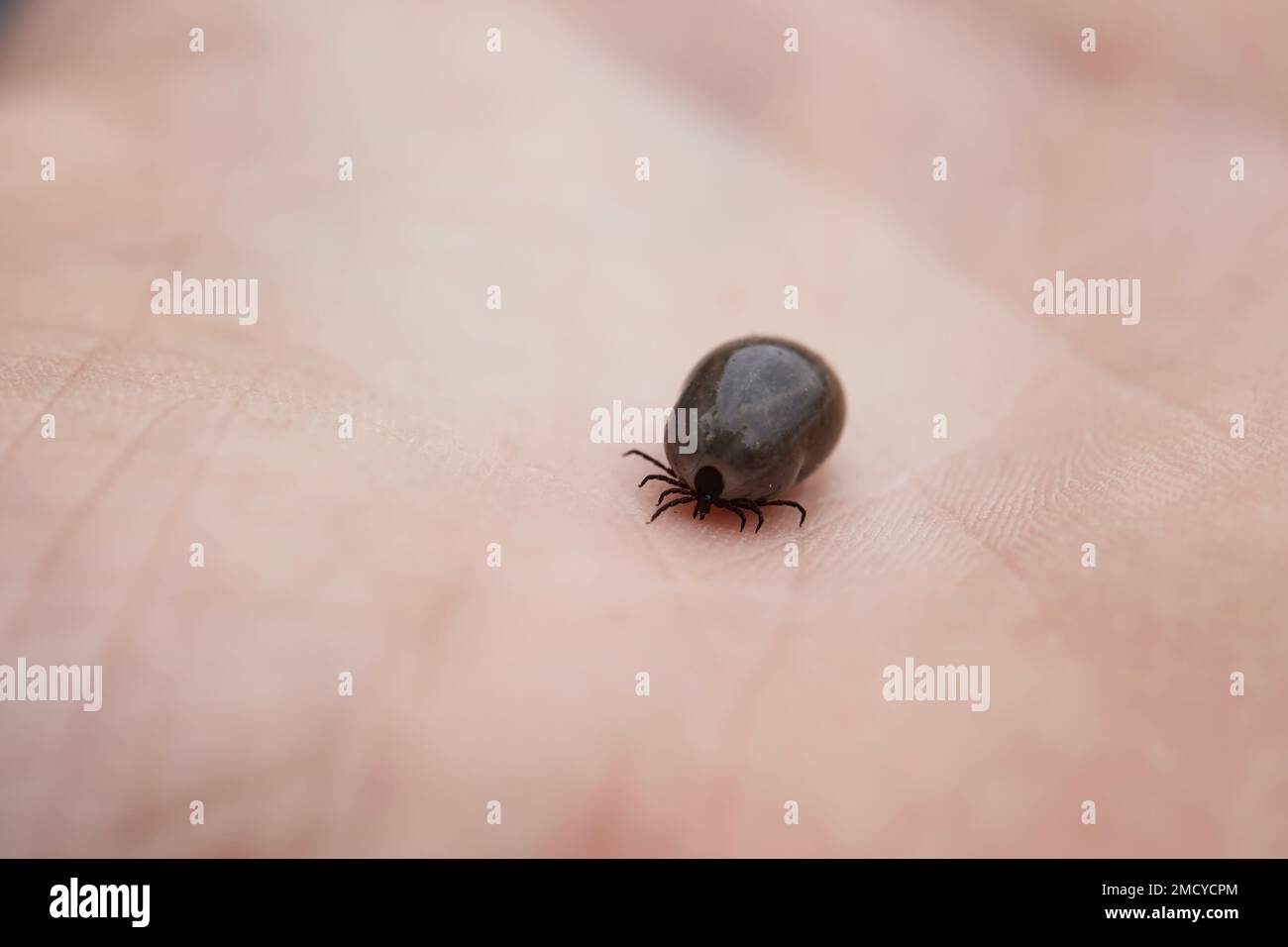 Fully fed tick on human hand. Close-up view of parasite on skin Stock ...