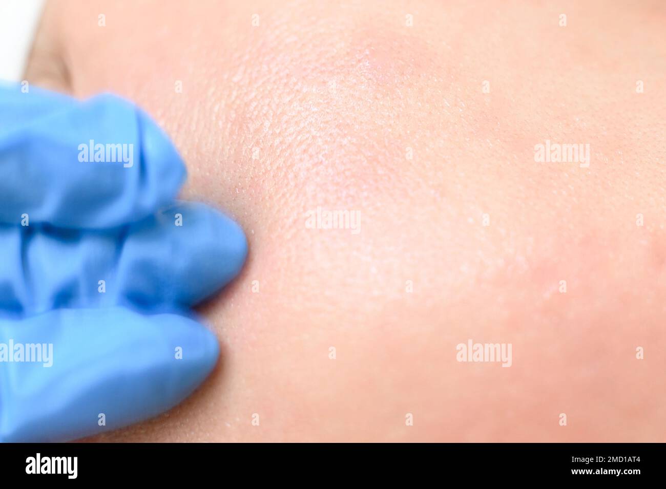 Open the pores of the skin woman female hi-res stock photography and ...