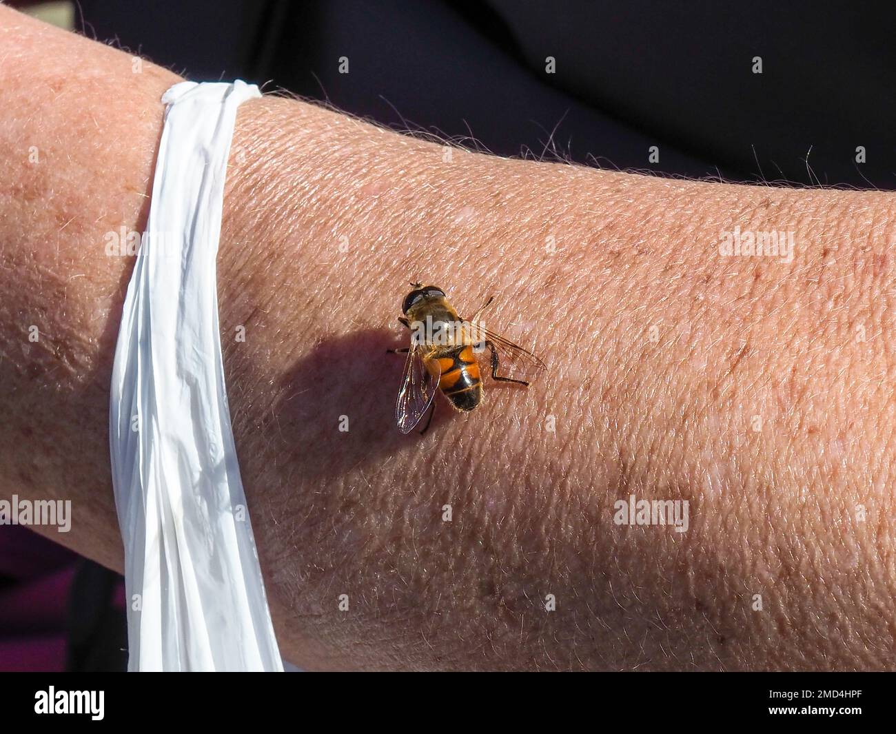 Bee sting skin hi-res stock photography and images - Alamy